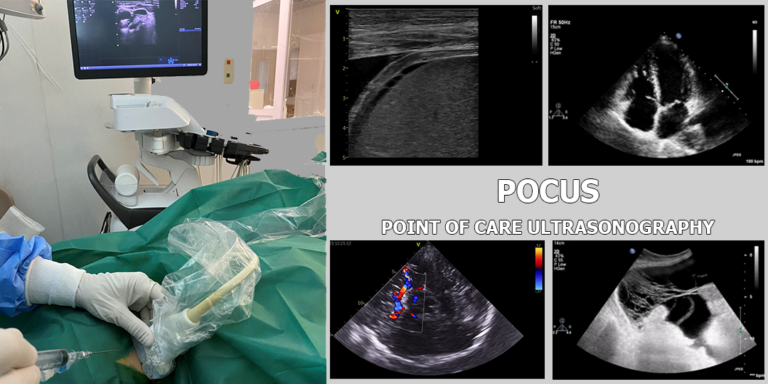 Υπερηχογραφία παρά την κλίνη σε Επείγουσες Καταστάσεις και Βαρέως Πάσχοντες – POCUS (Point of ...